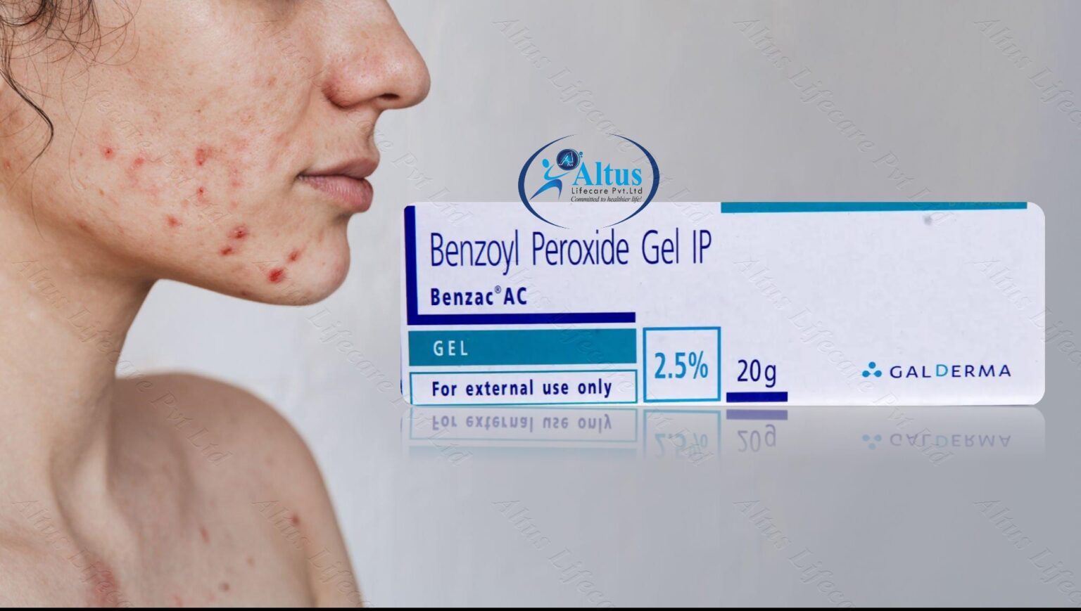 Benzac AC Gel: Your Solution for Clearer, Acne-Free Skin